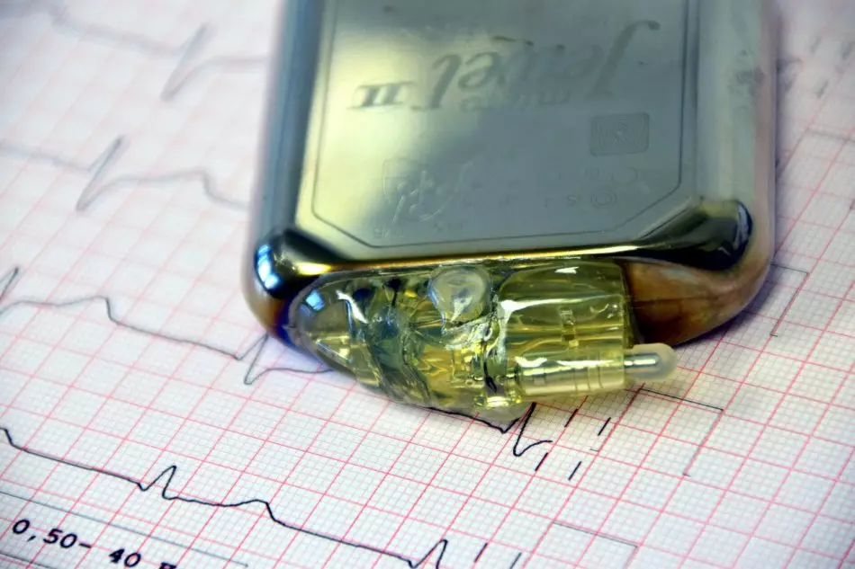 Kínai pacemaker áramellátás nélkül